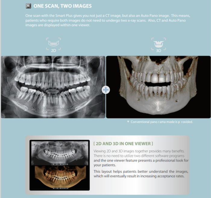 Vatech Smart Plus CBCT 3D - Crown Healthcare